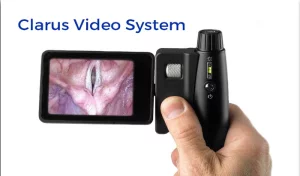 Clarus Video System - Clarus Medical LLC